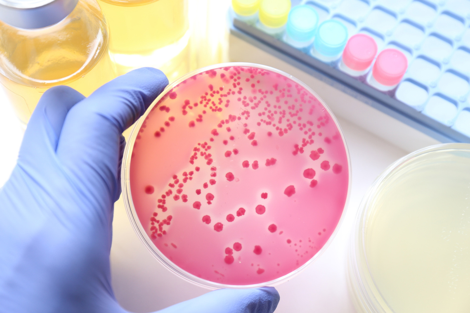 Bachelor's Degree in Microbiology - UAB Barcelona